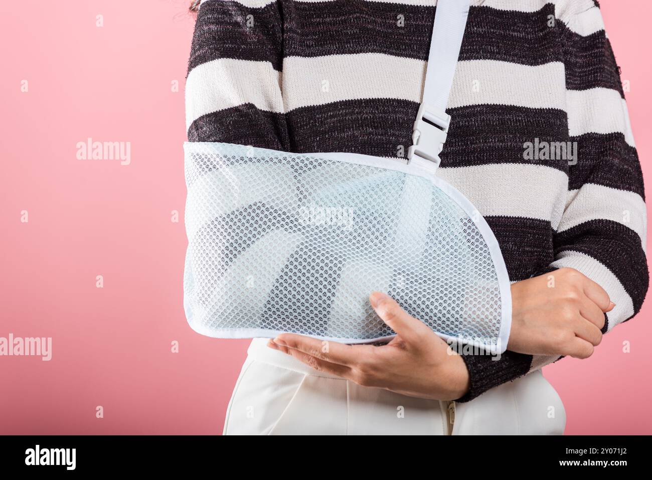 a businesswoman with a broken arm wears an arm splint and receives ...