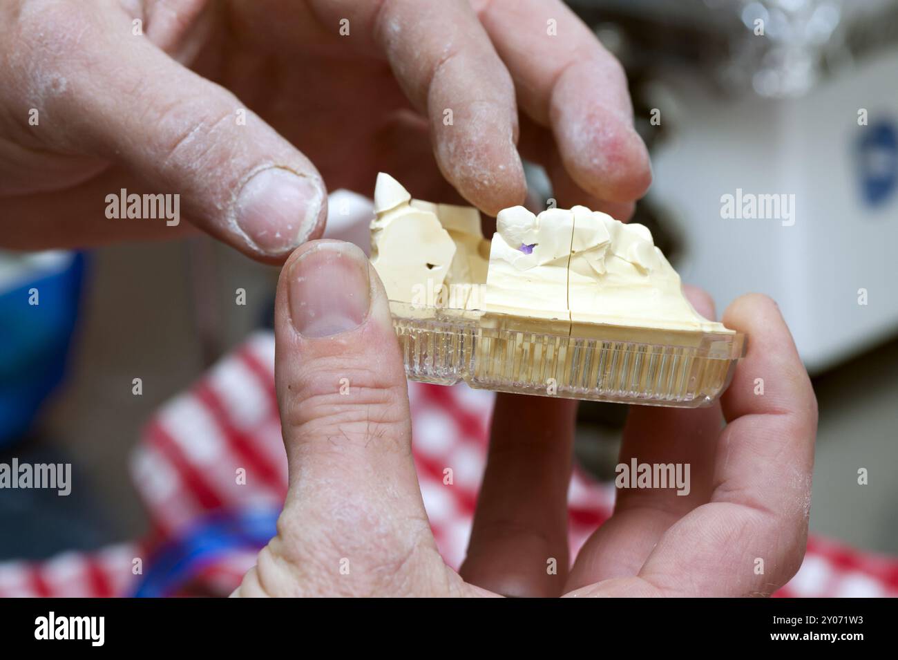 Individual parts of the denture model are put together Stock Photo - Alamy