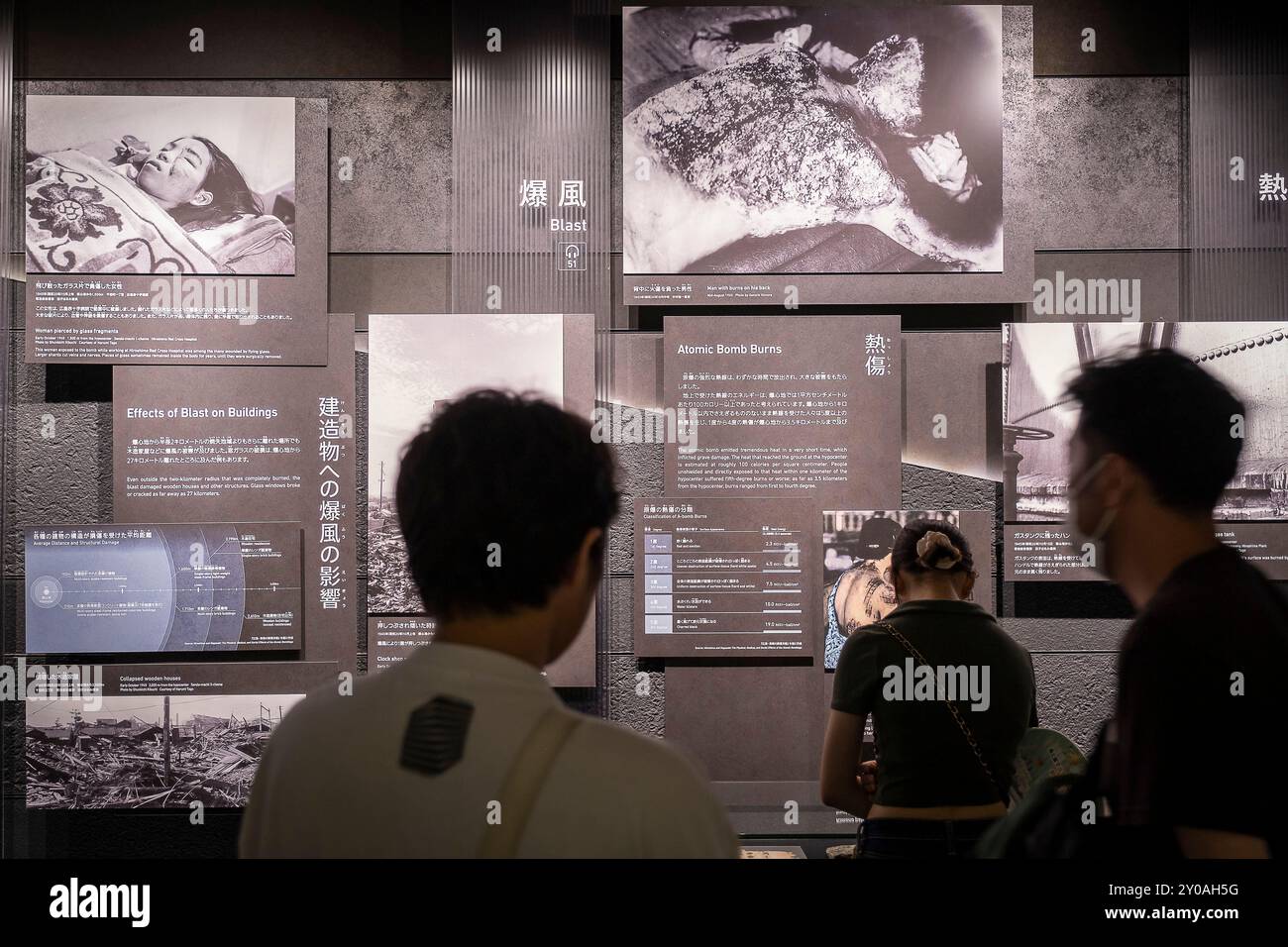 Images of people who suffered the effects of the atomic bombing ...