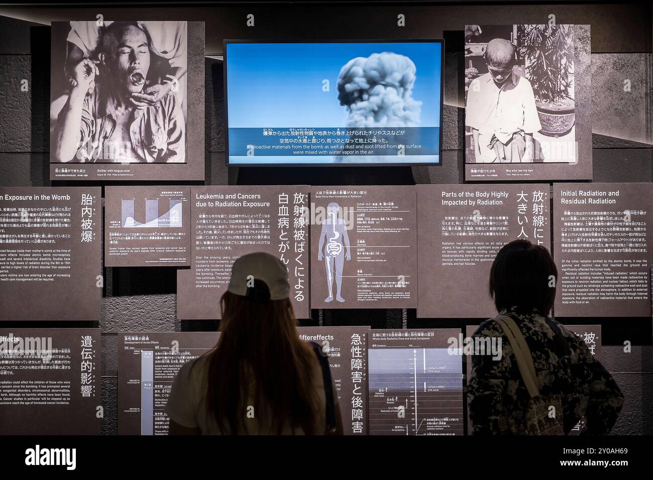 Images of people who suffered the effects of the atomic bombing ...