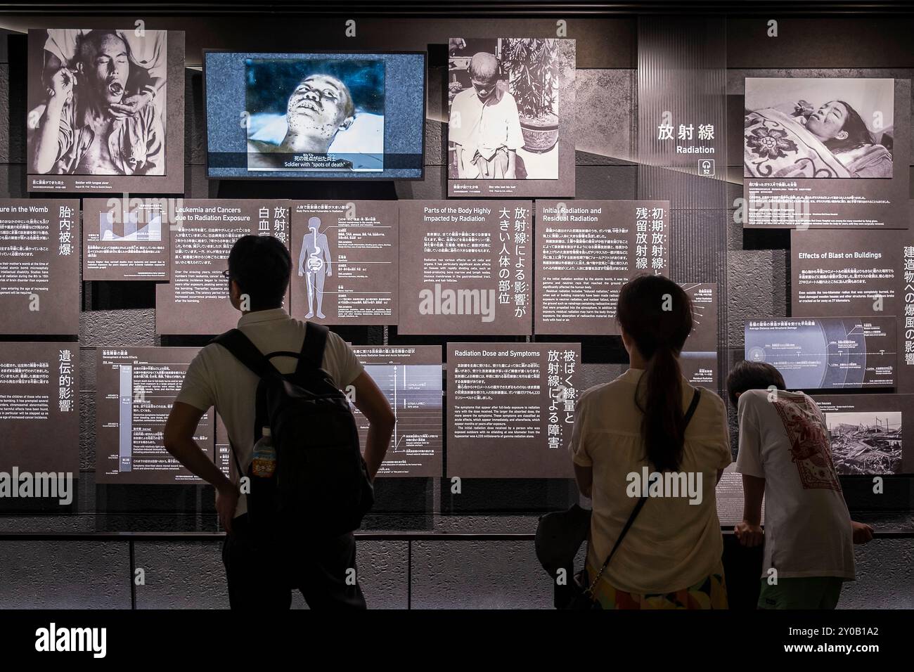 Documentary images of people who suffered the effects of the atomic ...