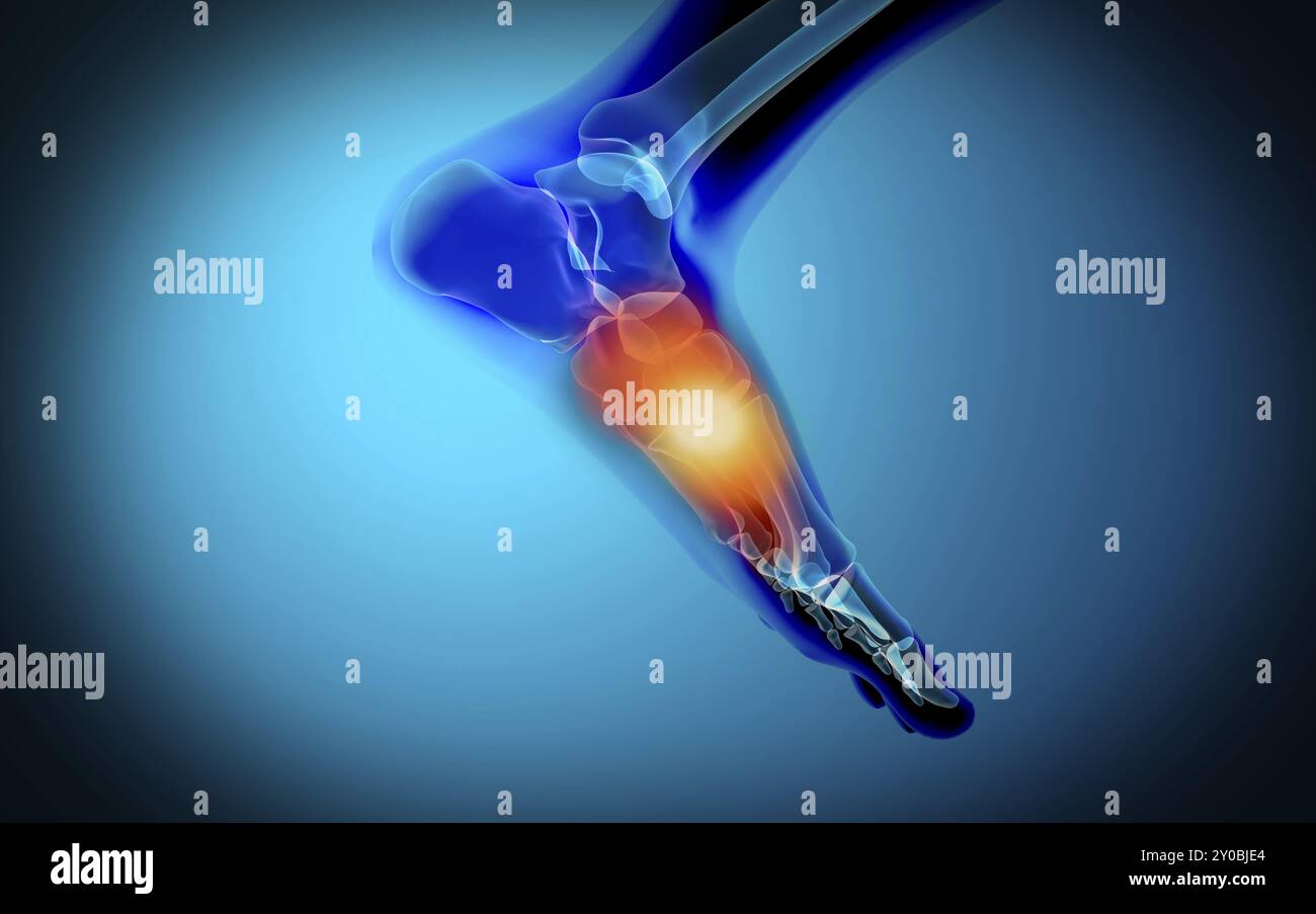 Pain in the foot hi-res stock photography and images - Alamy