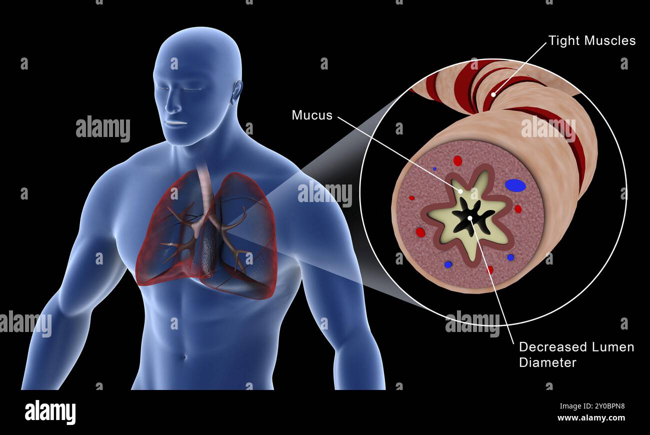 Respiratory pathogens hi-res stock photography and images - Alamy