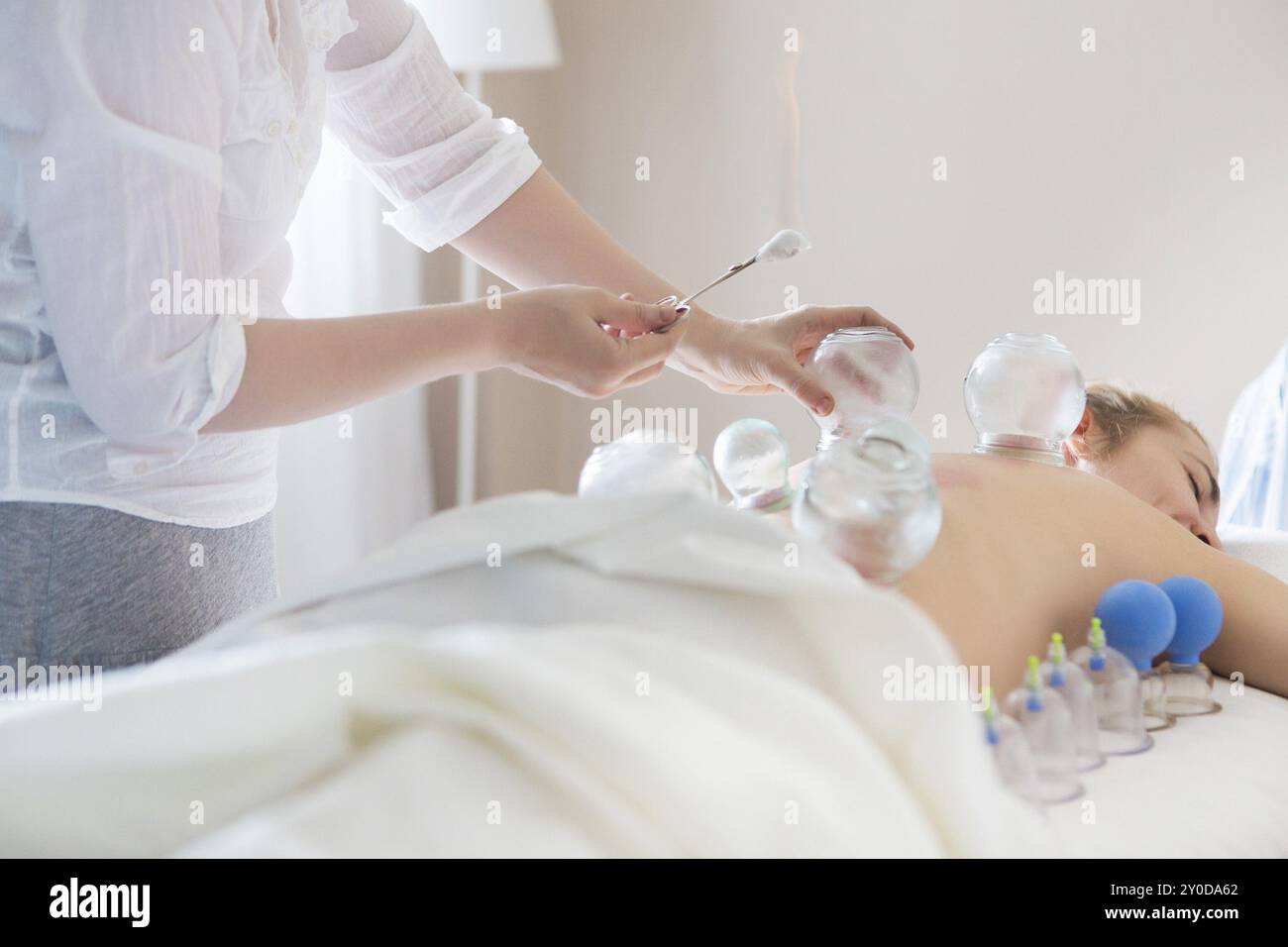 Young woman getting treatment at medical clinic. Fire cupping cups on ...