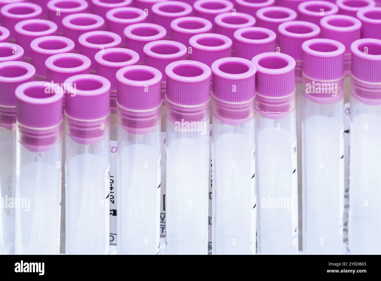 Covid-19 outbreak blood test. Close up view of empty test tubes for ...