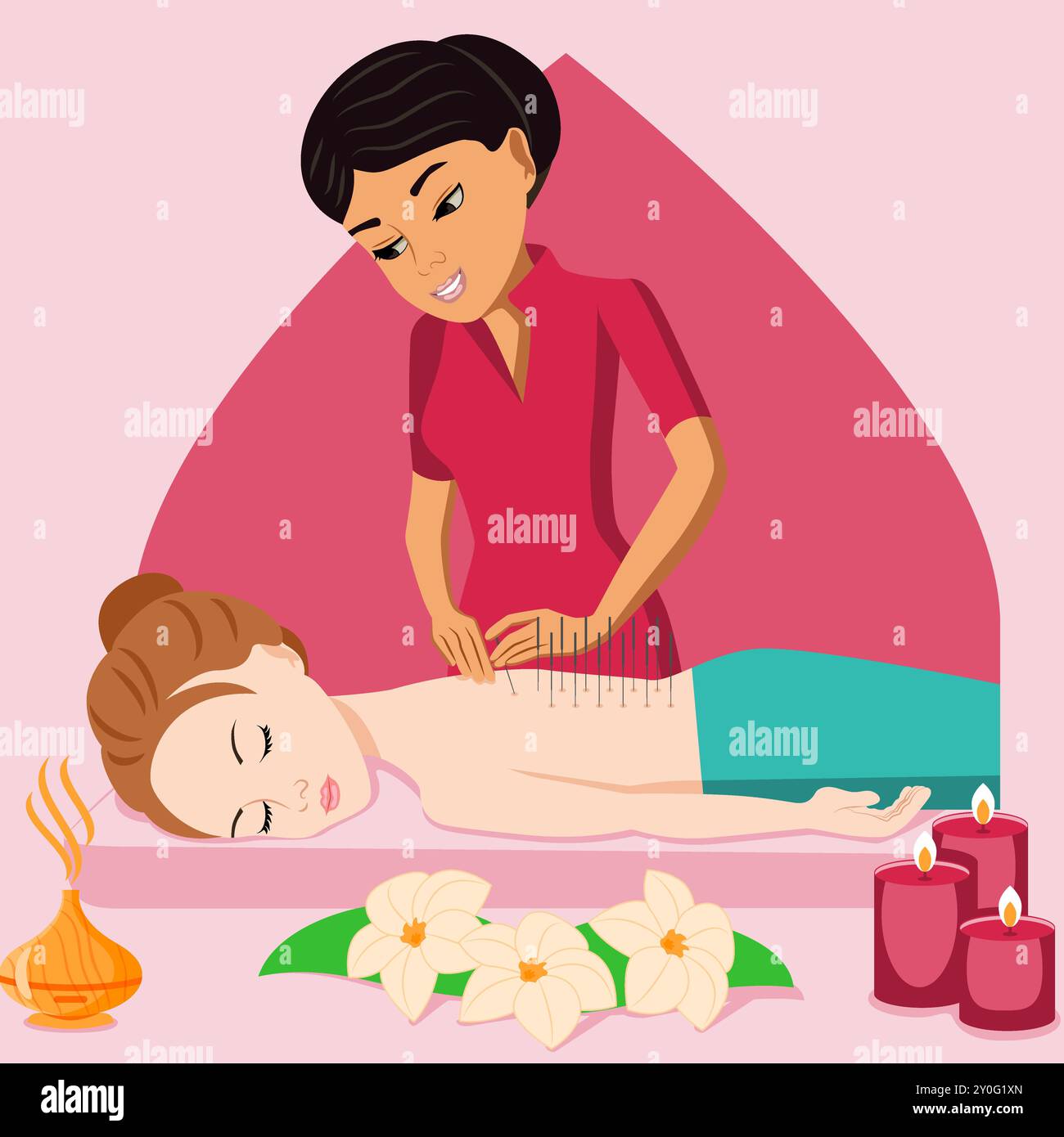 Needle Acupuncture treatment by professional acupuncturist in spa ...