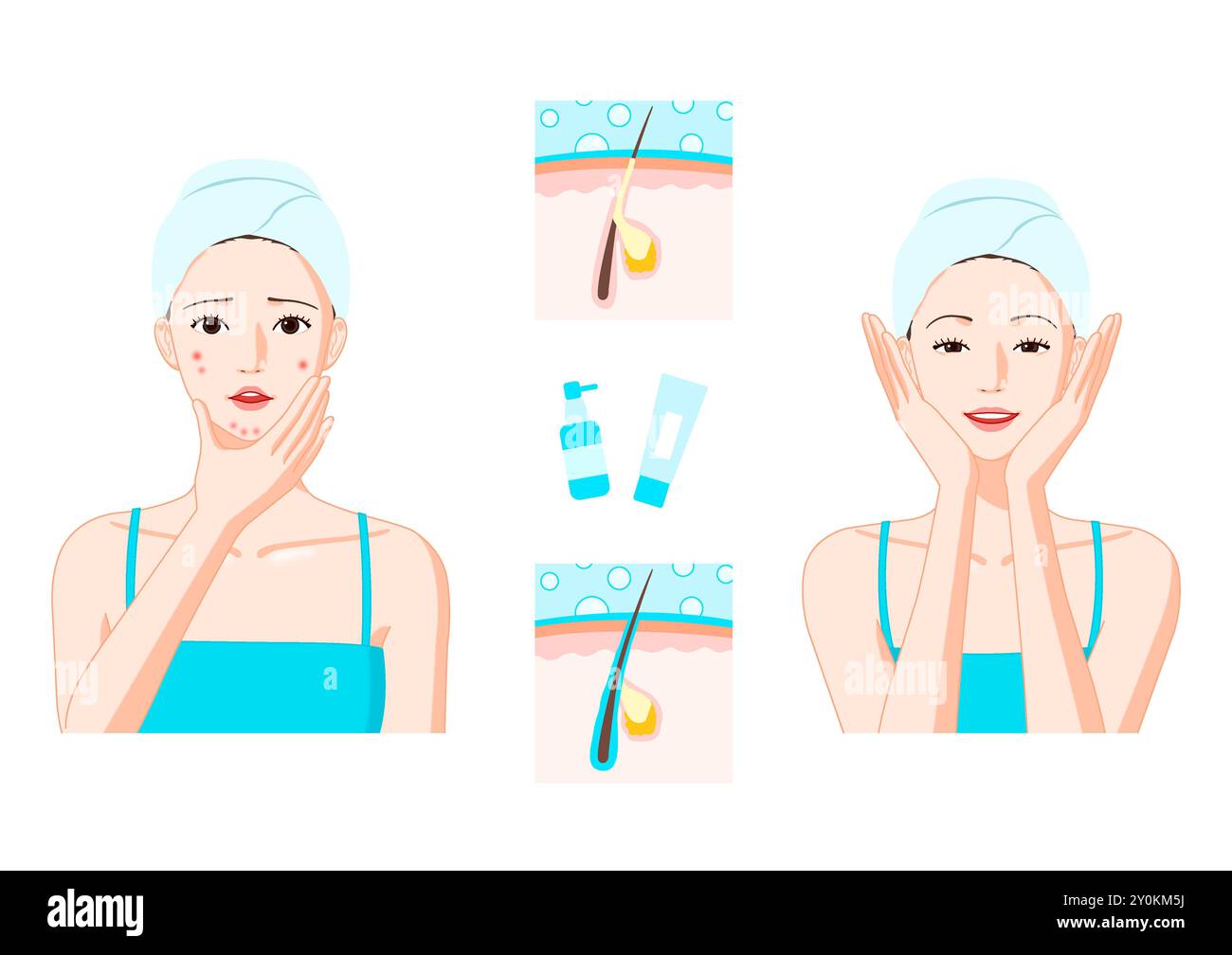 Woman taking care to get rid of skin disease Stock Photo - Alamy