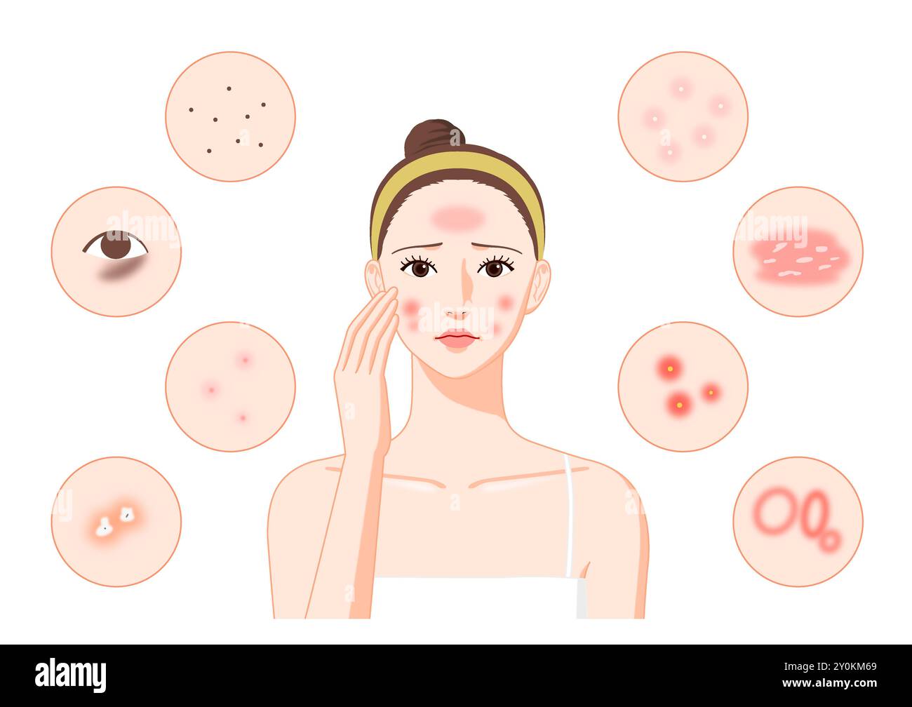 Various types of skin diseases Stock Photo - Alamy