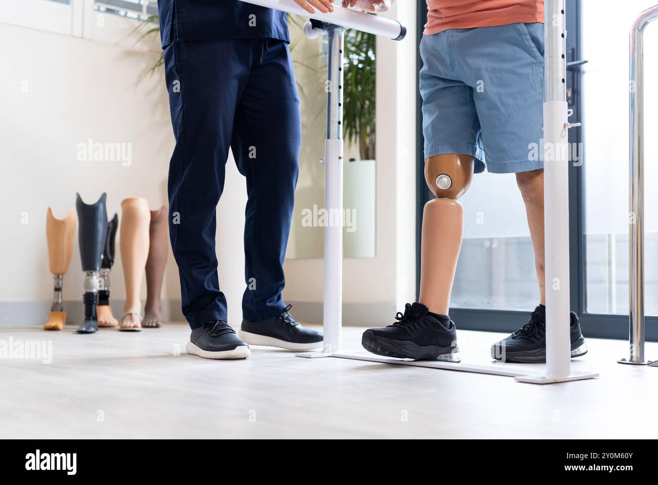 Man with prosthetic leg walking using parallel bars with therapist in ...