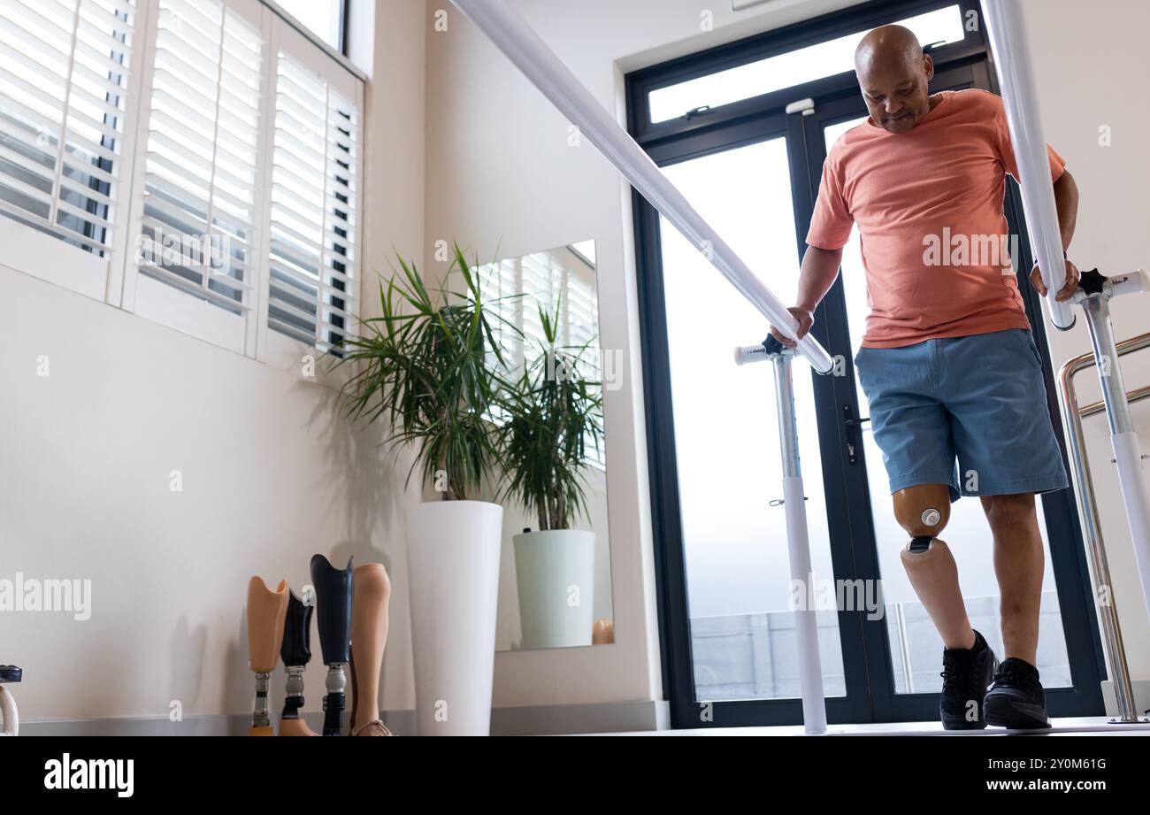 Man with prosthetic leg walking using parallel bars in rehabilitation ...