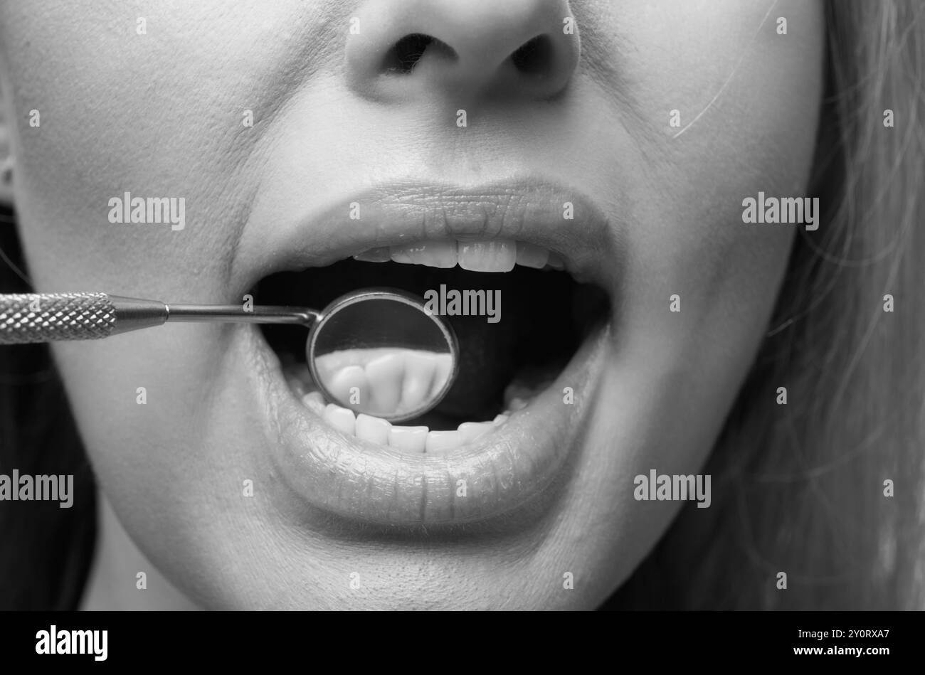 Dentist teeth mirror close-up. Examination of teeth with dental mirror ...