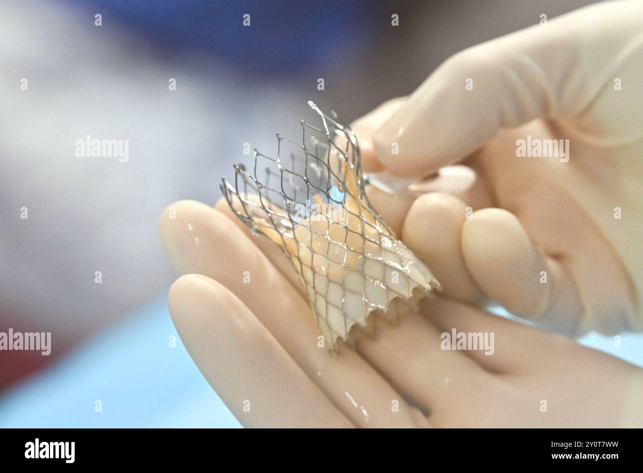 Healthcare professional a holding a stent for a transcatheter aortic ...