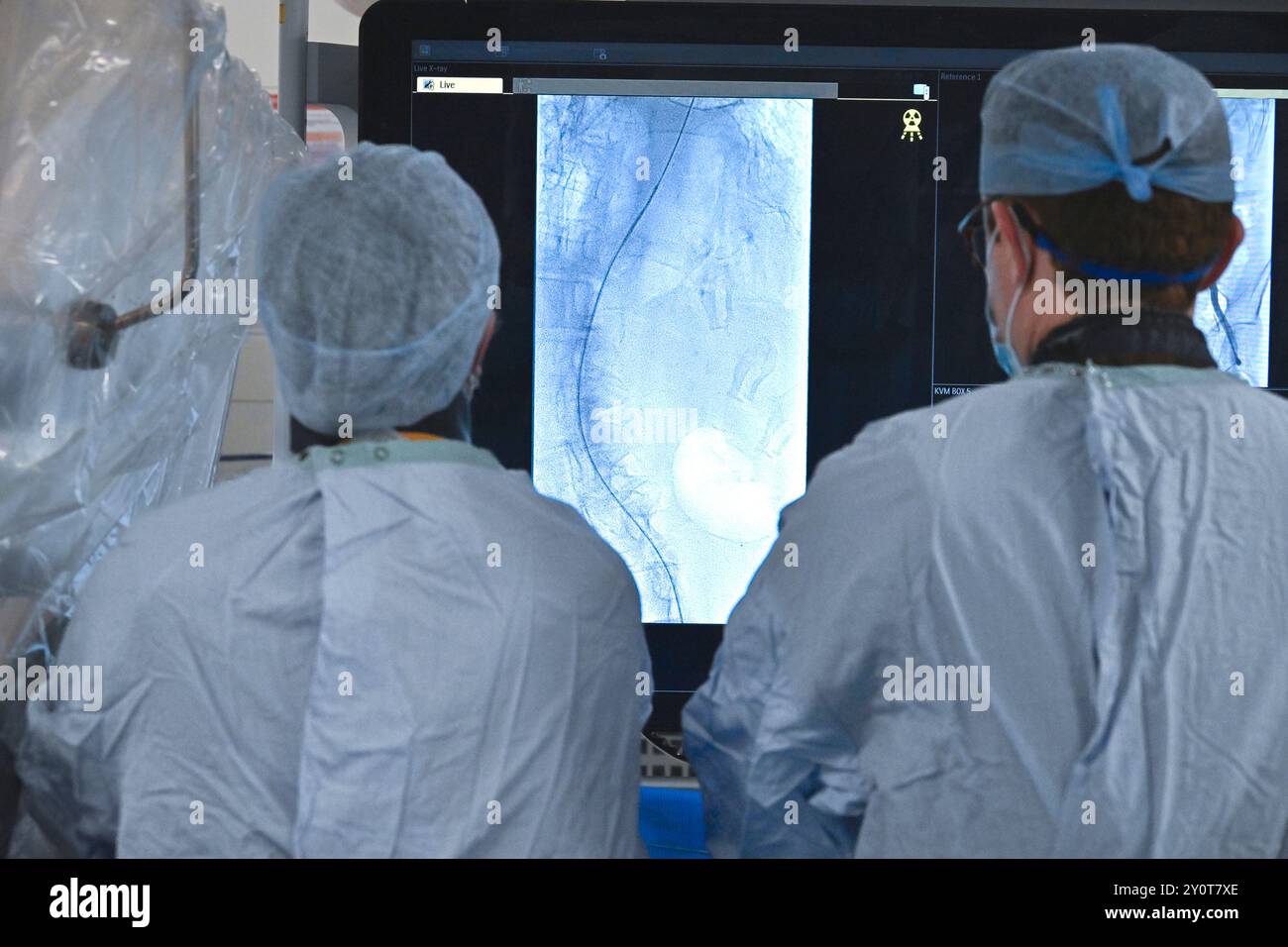 Doctors observing a live X-ray during a transcatheter aortic valve ...