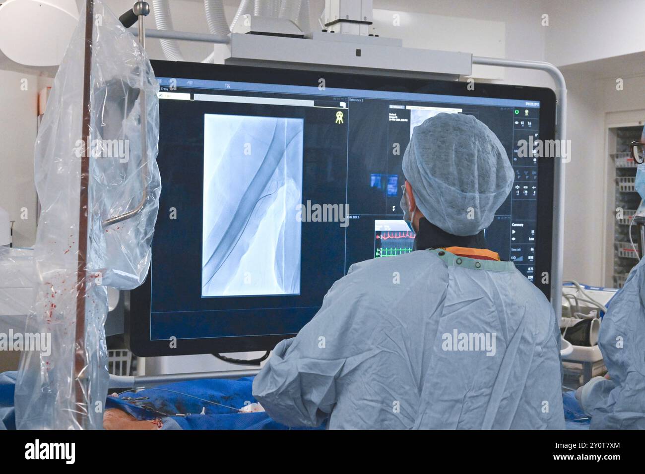 Doctors observing a live X-ray during a transcatheter aortic valve ...