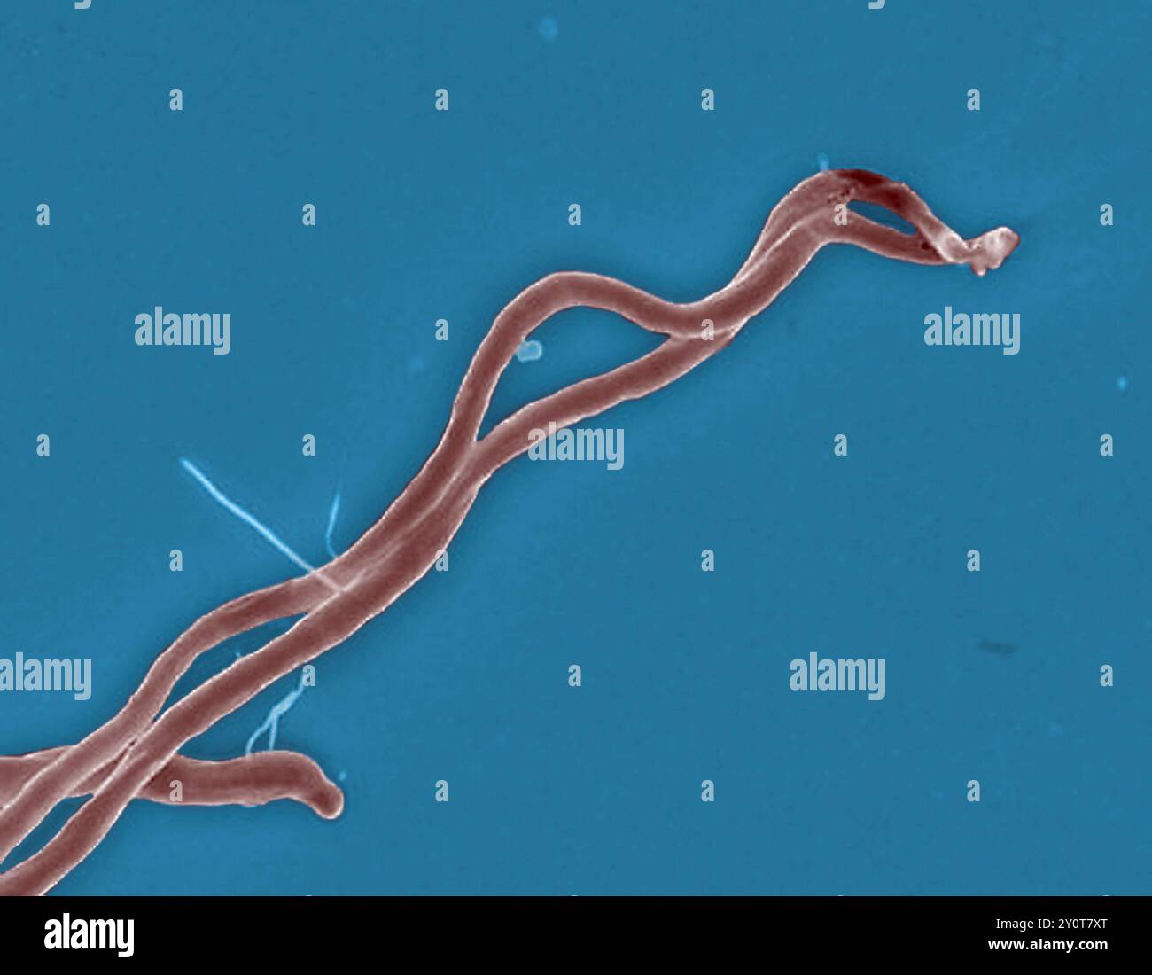 Coloured scanning electron micrograph (SEM) of Borrelia burgdorferi ...