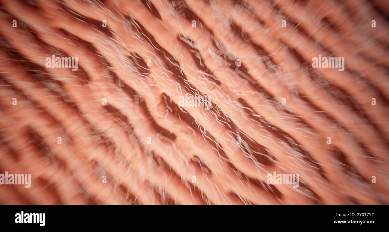Illustration of human heart tissue affected by amyloid light chain (AL ...