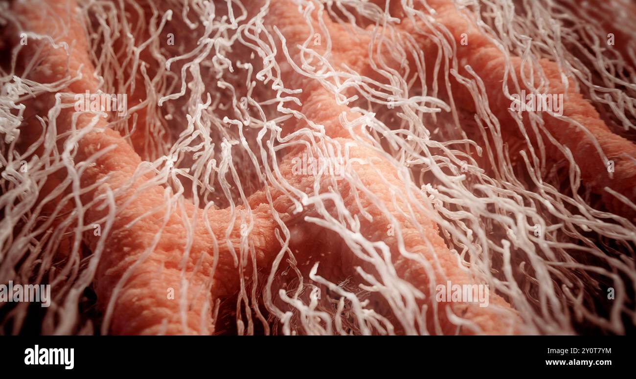 Illustration of human heart tissue affected by amyloid light chain (AL ...