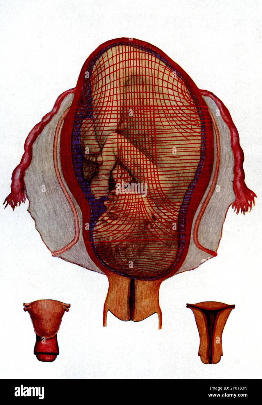 Illustration of a fully-developed child in the delivery position (head ...