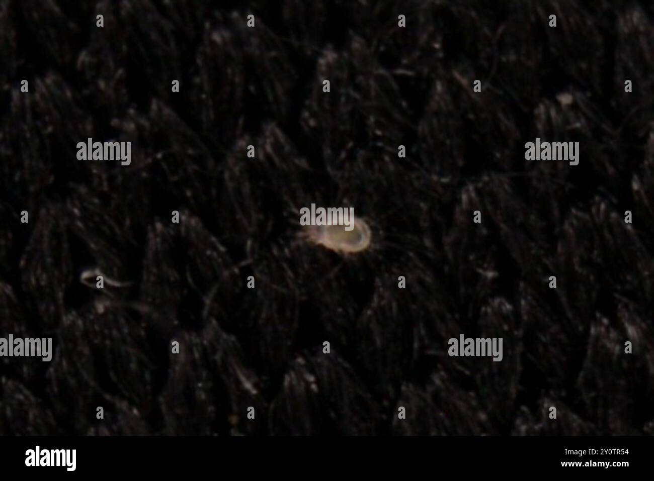 Mites and Ticks (Acari) Arachnida Stock Photo - Alamy