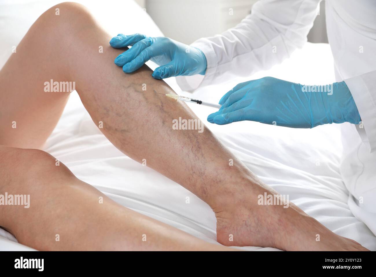 Varicose veins treatment. Doctor giving injection to patient indoors ...