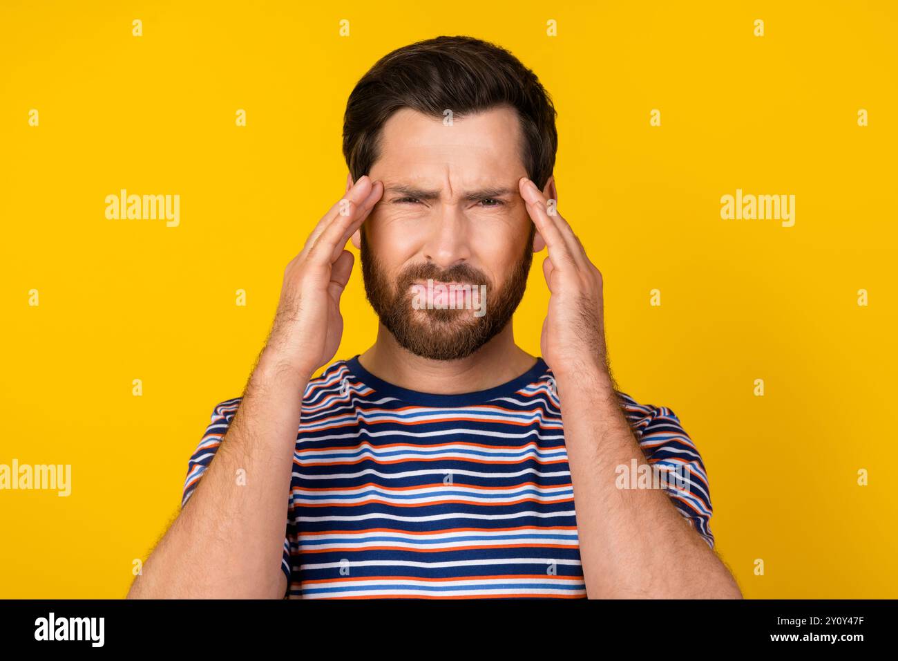 Photo of overwhelmed man with stylish beard dressed striped shirt arm ...