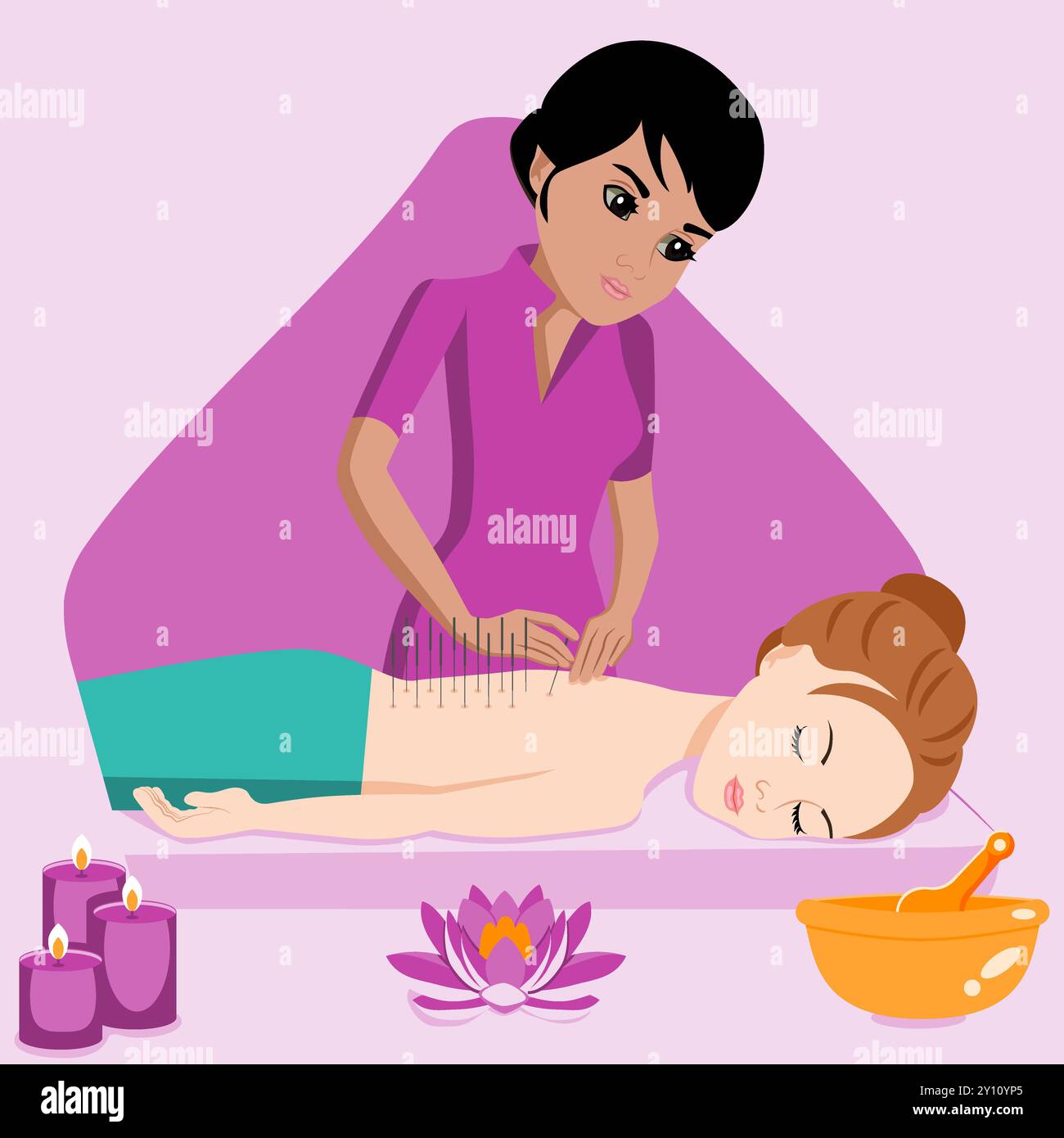 Needle Acupuncture treatment by professional acupuncturist in spa ...