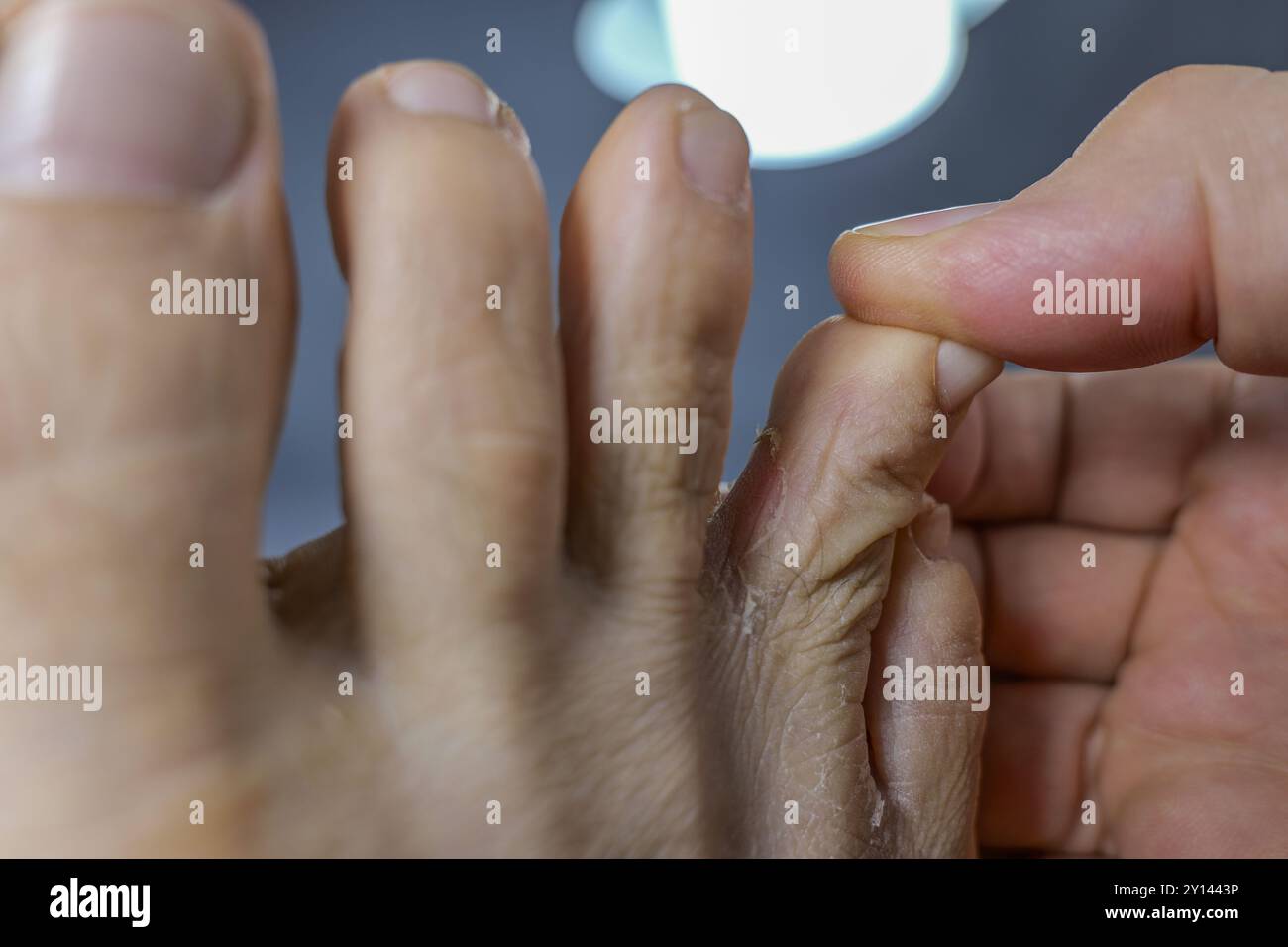 Male toes hi-res stock photography and images - Alamy