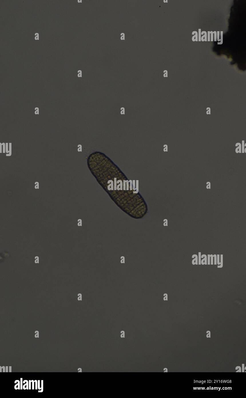 (Lopadium disciforme) Fungi Stock Photo - Alamy