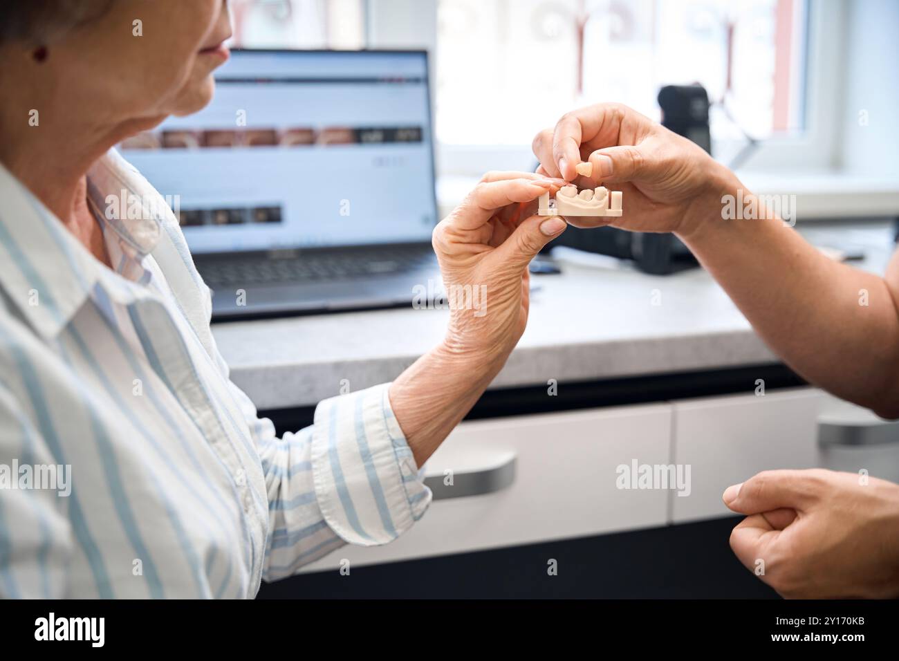 Doctor demonstrates to the patient technique of prosthetics using crown ...