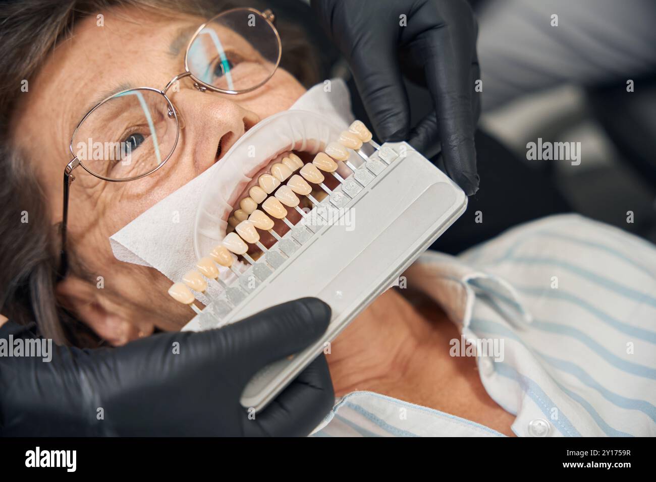 Specialist selects the color of dental crown for patient Stock Photo ...