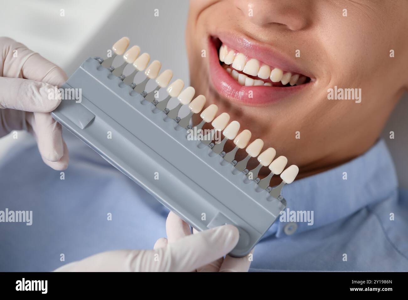 Doctor checking young man's teeth color in clinic, closeup. Dental ...