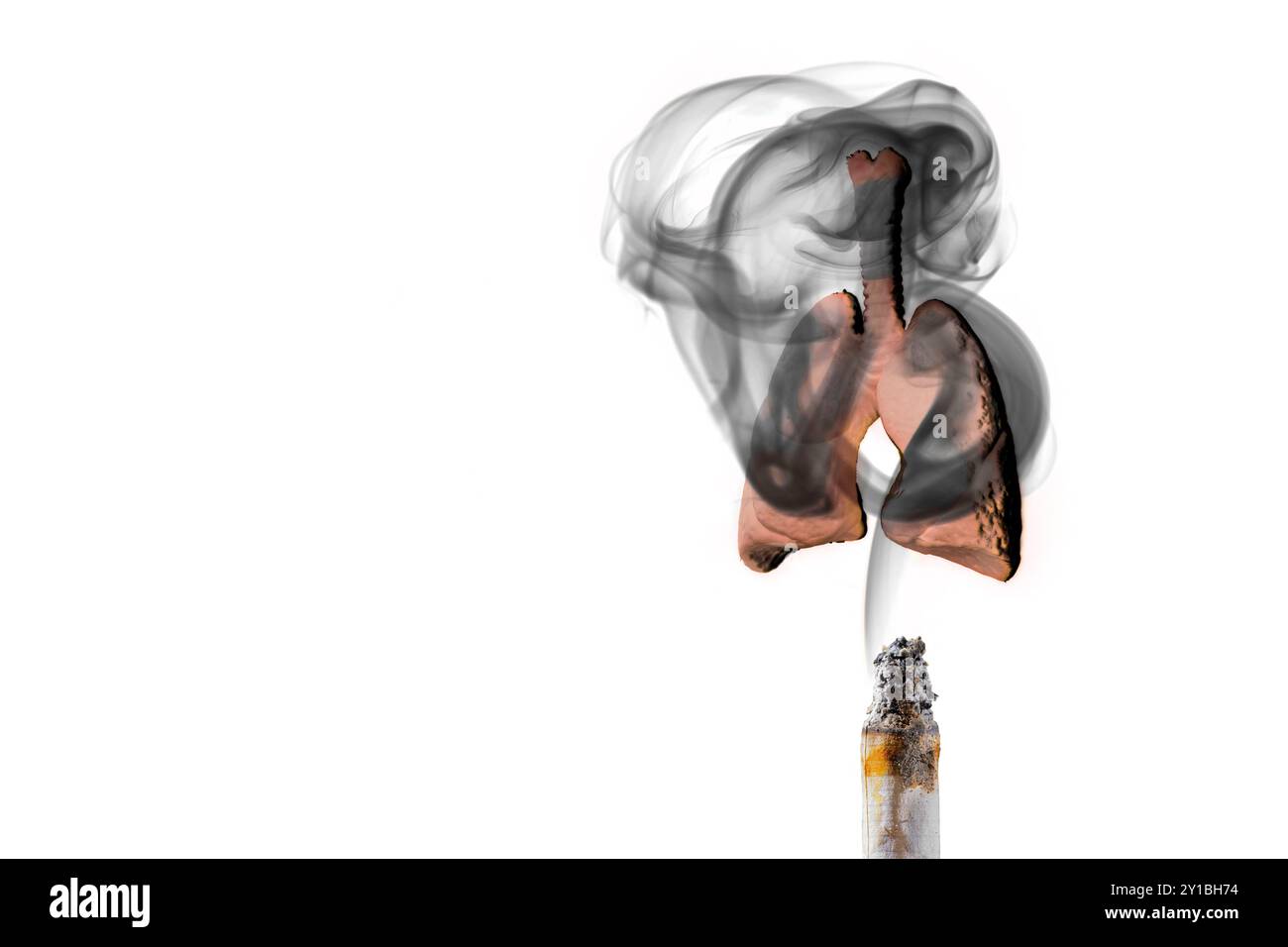 Effects of smoking hi-res stock photography and images - Alamy