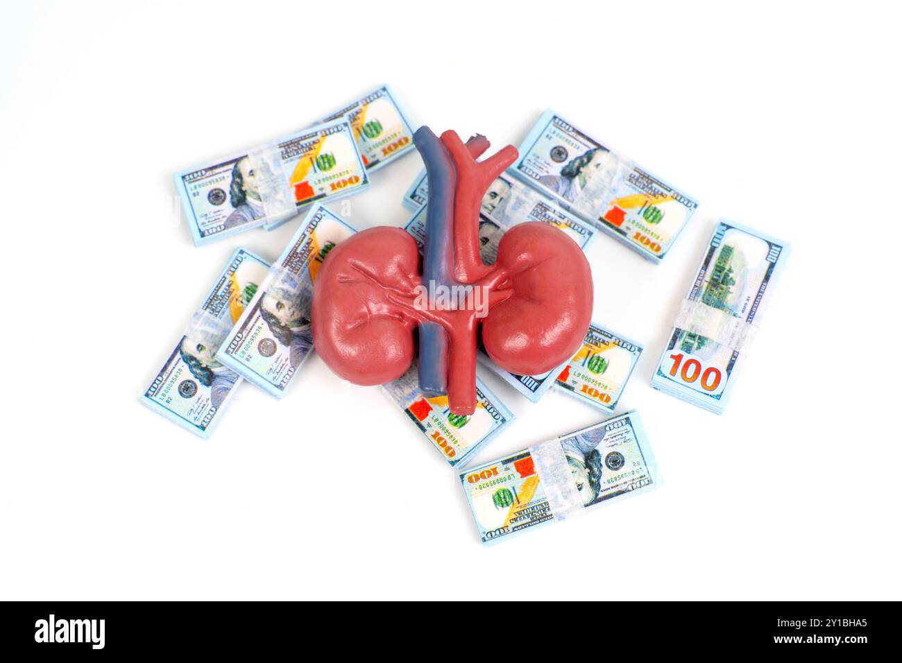 Kidney model placed on white background surrounded by miniature stacks ...