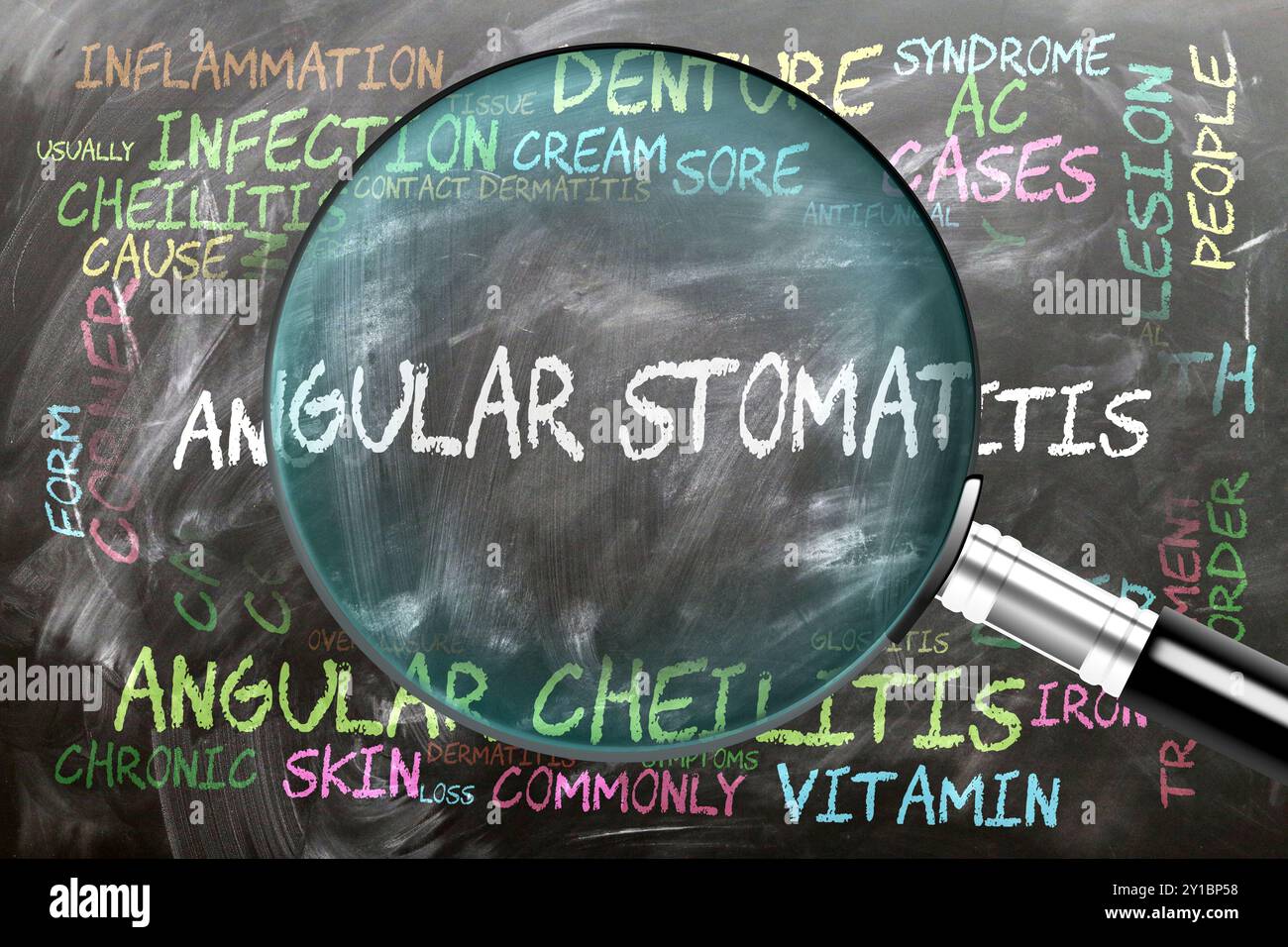 Angular Stomatitis being studied, examined - under close inspection ...