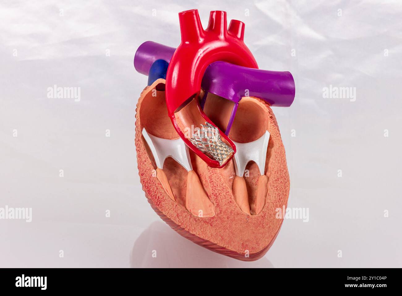 Cardiac model of Transcatheter aortic valve implantation (TAVI) for ...