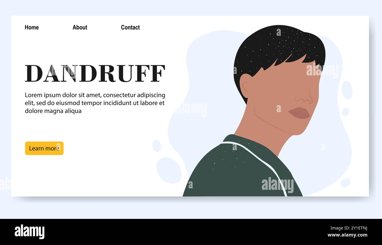 Scalp infection vector medicine banner. Man with dandruff illustration ...