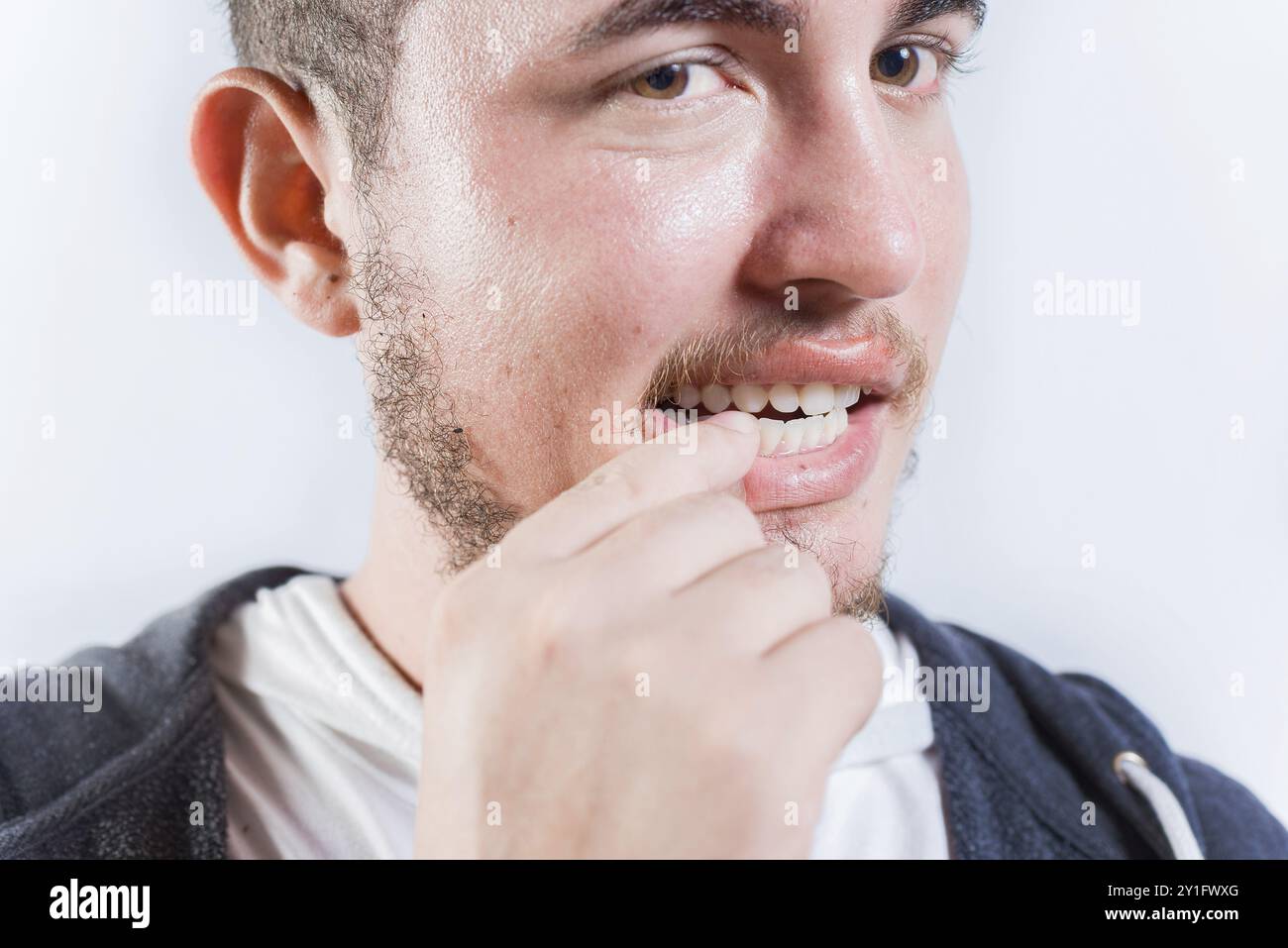 Close up of man with dermatophagia, biting his nails. Person biting ...