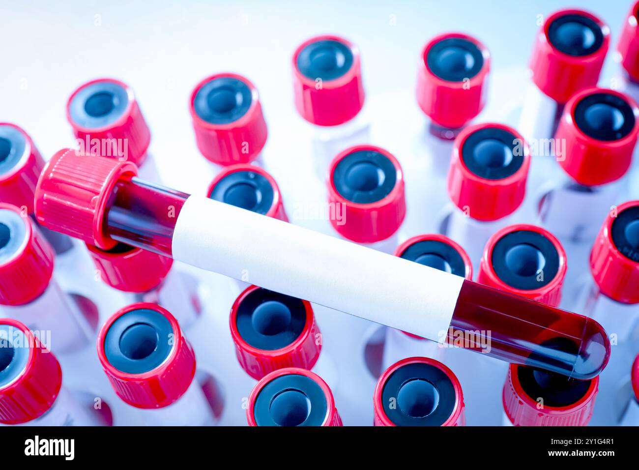 One sample tube with blood and blank label on others, closeup ...