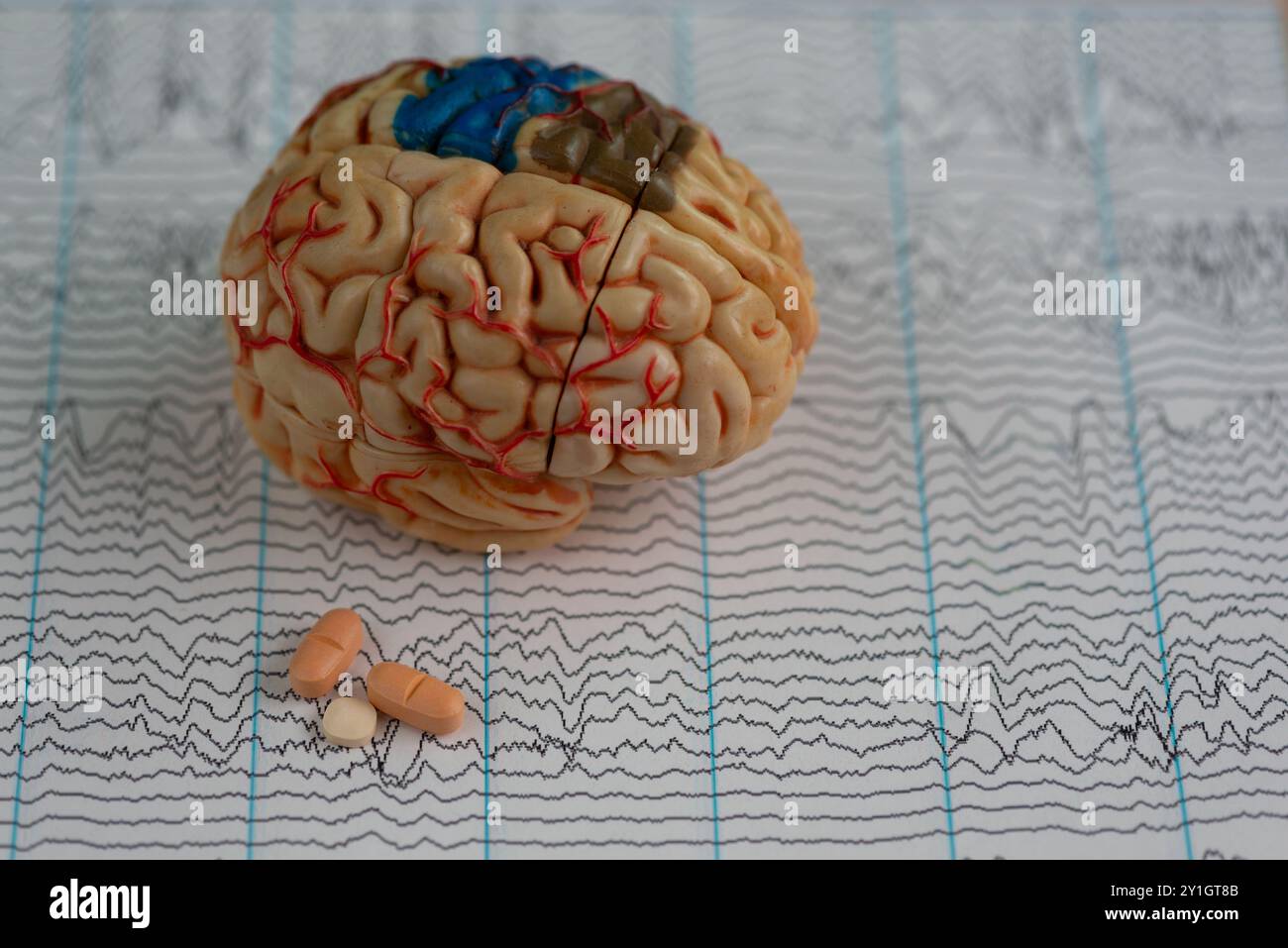A brain model placed on an EEG (electroencephalogram) graph ...