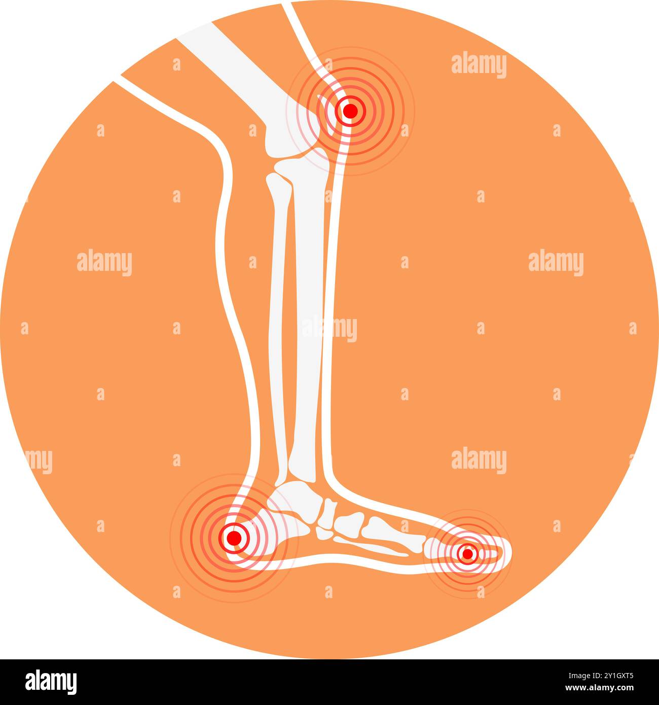 Zone therapy Stock Vector Images - Alamy
