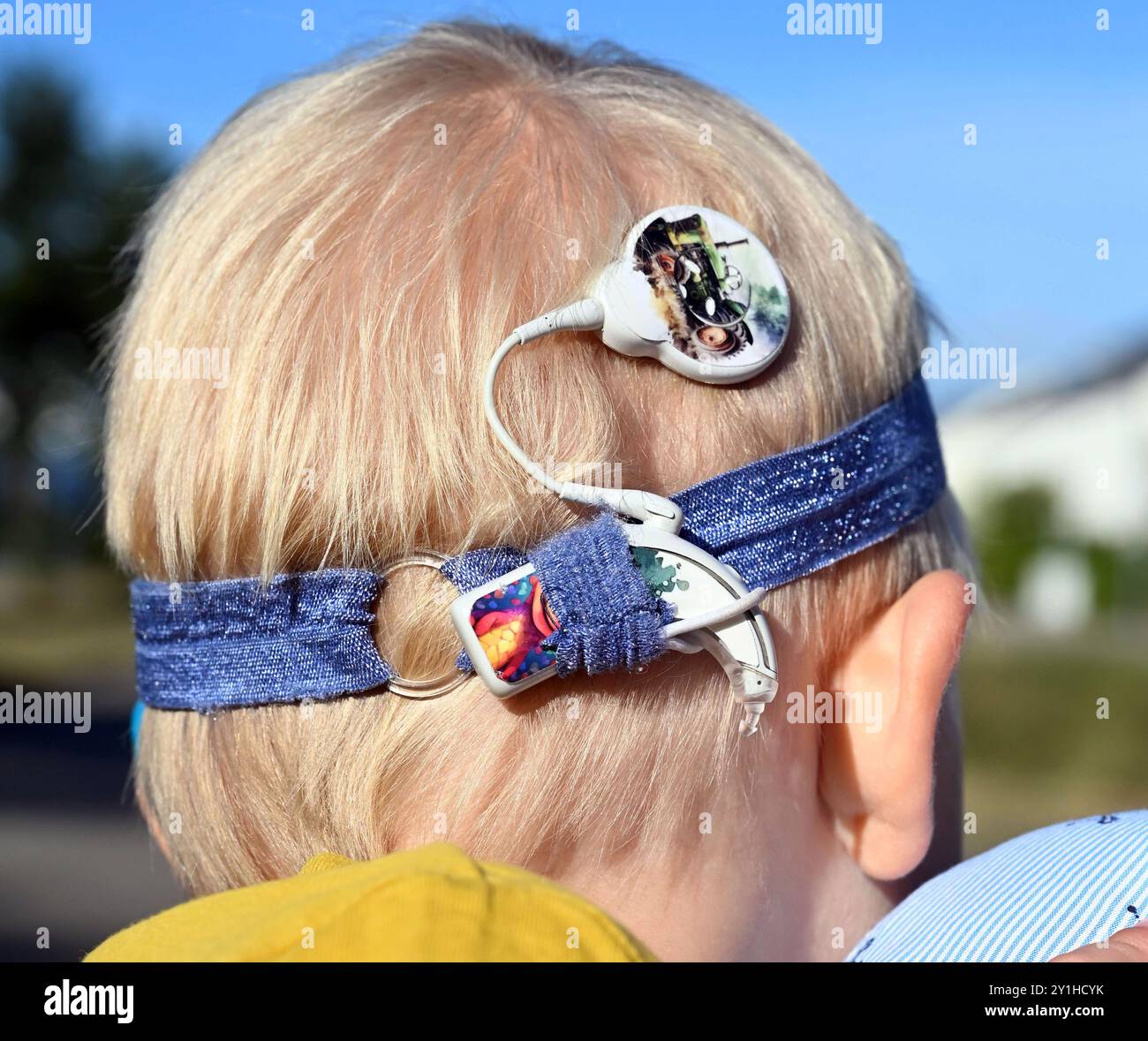 Karlsruhe, Germany. 07th Sep, 2024. A cochlear implant, a hearing ...