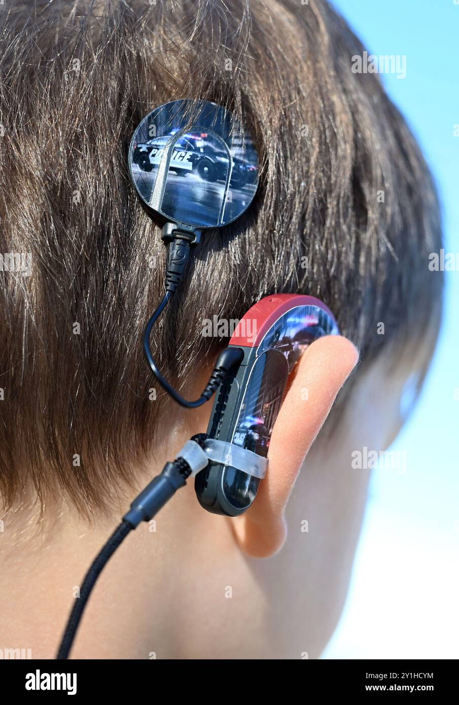 Karlsruhe, Germany. 07th Sep, 2024. A cochlear implant, a hearing ...