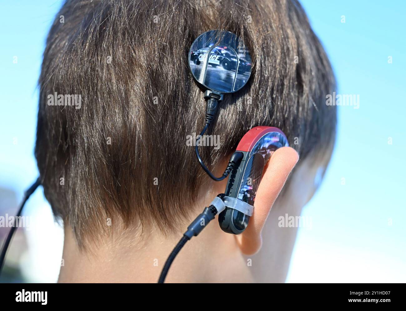 Karlsruhe, Germany. 07th Sep, 2024. A cochlear implant, a hearing ...