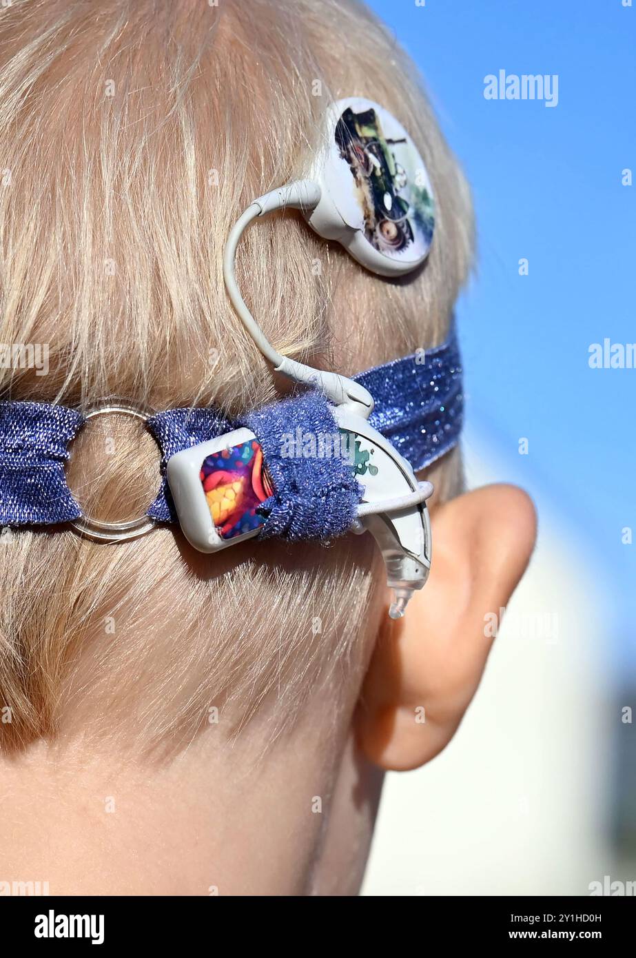 Karlsruhe, Germany. 07th Sep, 2024. A cochlear implant, a hearing ...