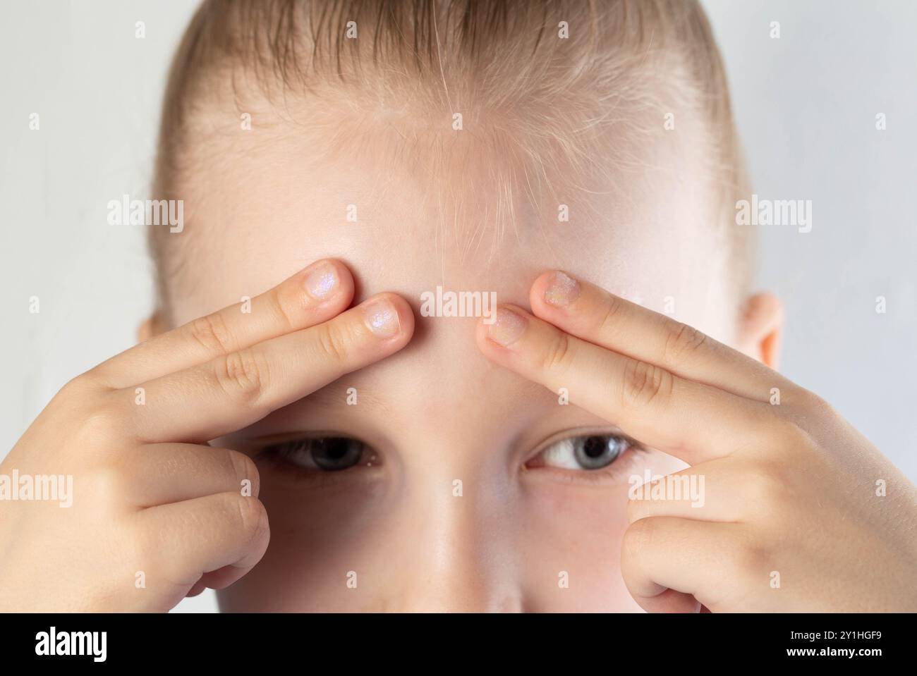 The girl holds her forehead and head with her fingers. Concept of pain ...