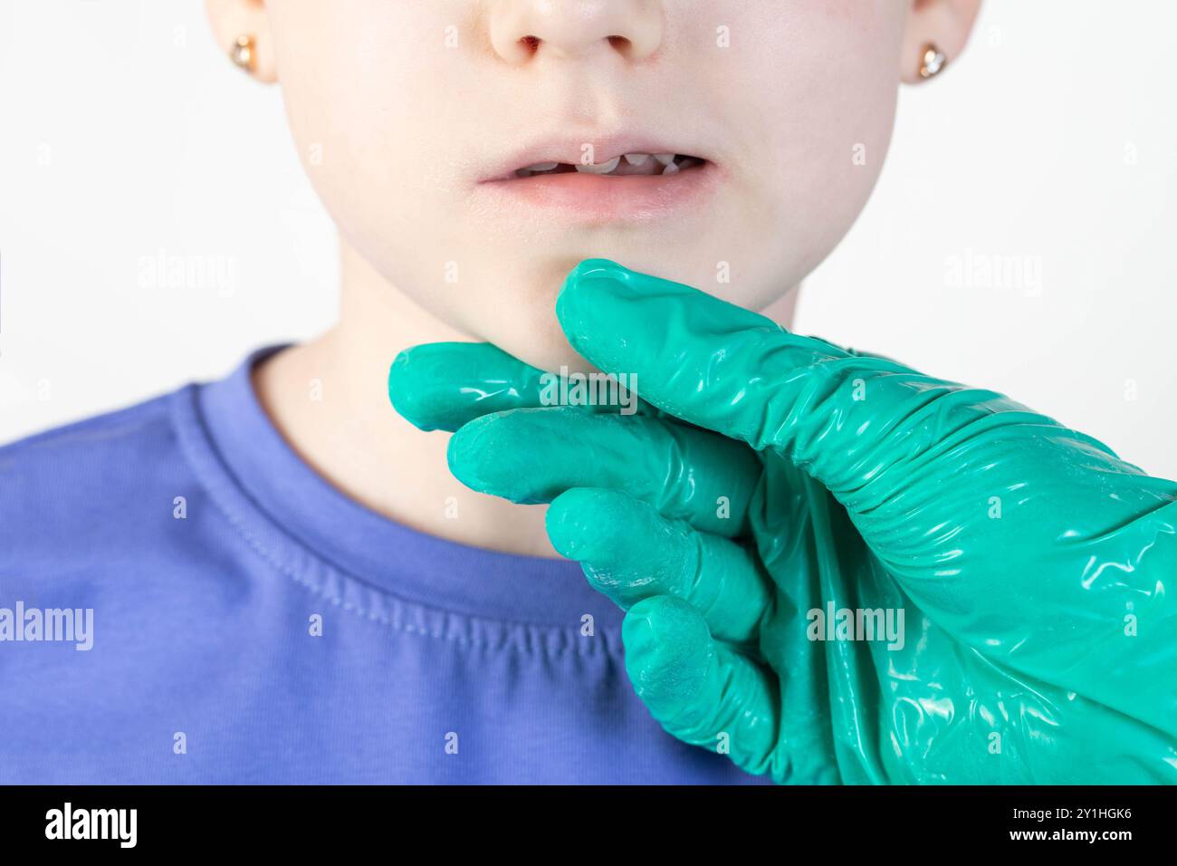 The doctor examines the jaw of a girl who has an incorrect bite ...