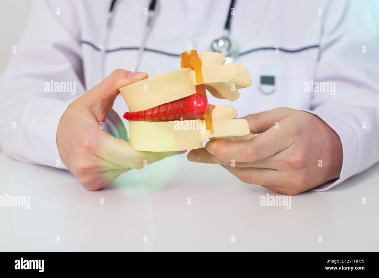 A doctor neurosurgeon holds in his hands a medical model of the spine ...