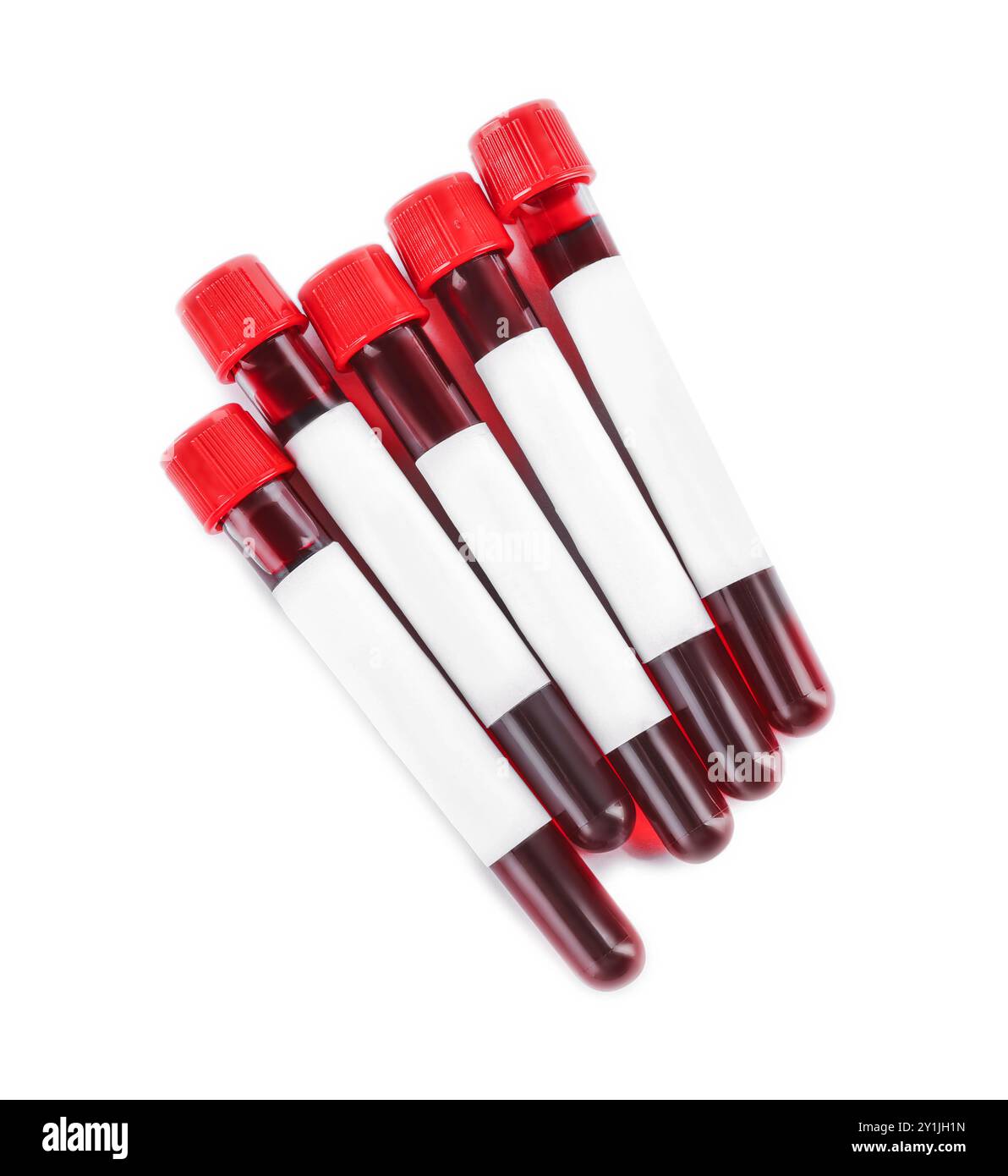 Blood in test tubes with blank labels on white background. Medical ...