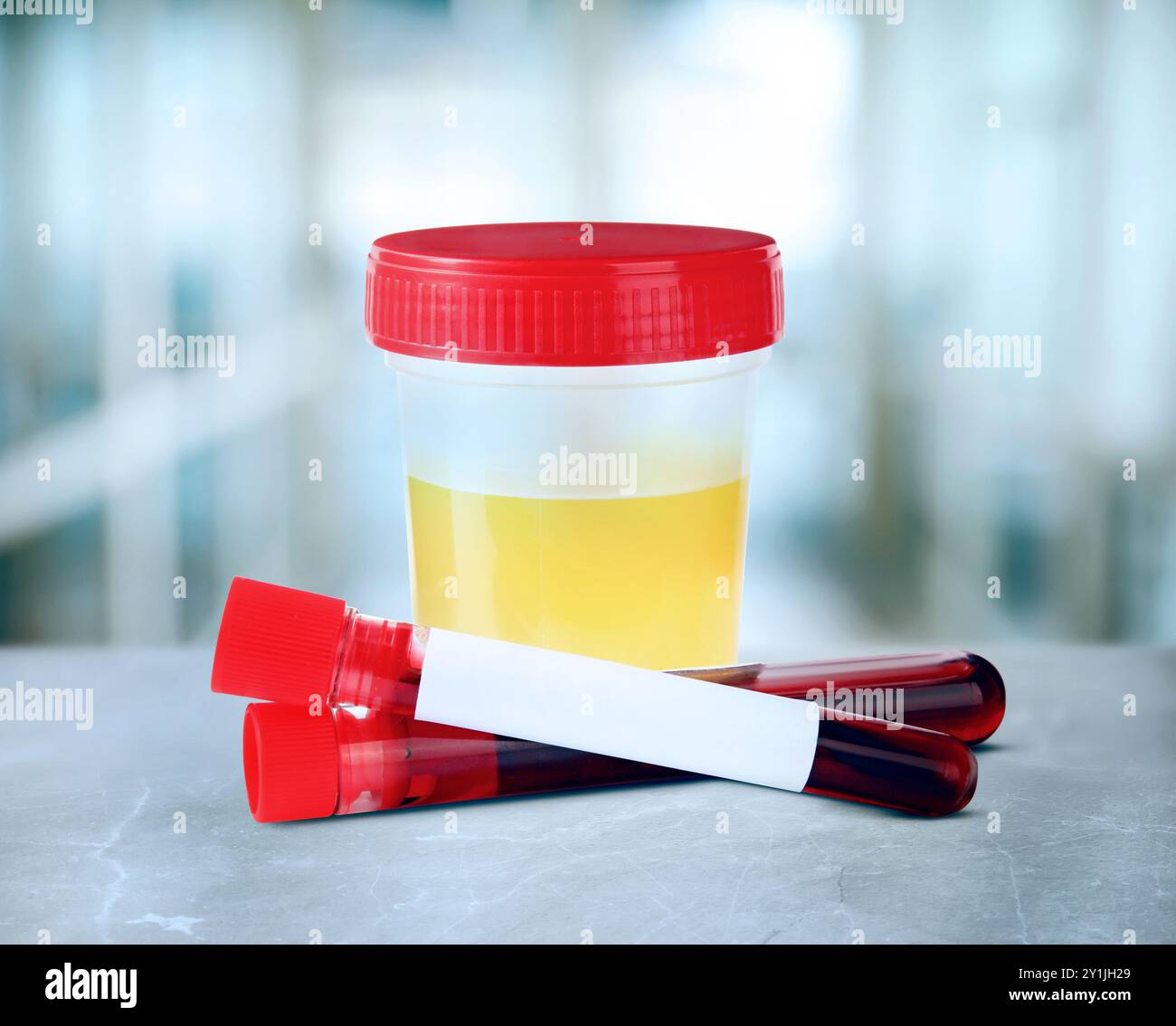 Test tubes with blood samples and jar of urine on table in laboratory ...