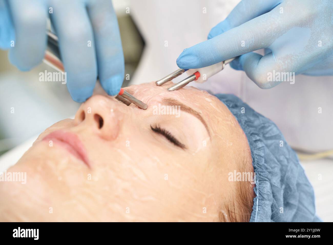 Dermatology anti age treatment. Microcurrent medicine procedure. Woman ...